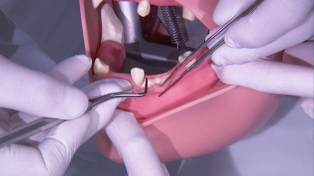 Упражнения на имплантатах (2 часть, поднятие клапана)