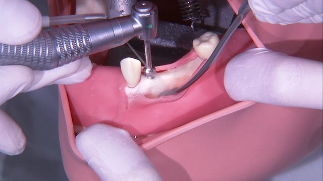 Упражнения на имплантах ( 8 часть, профилированная подготовка)