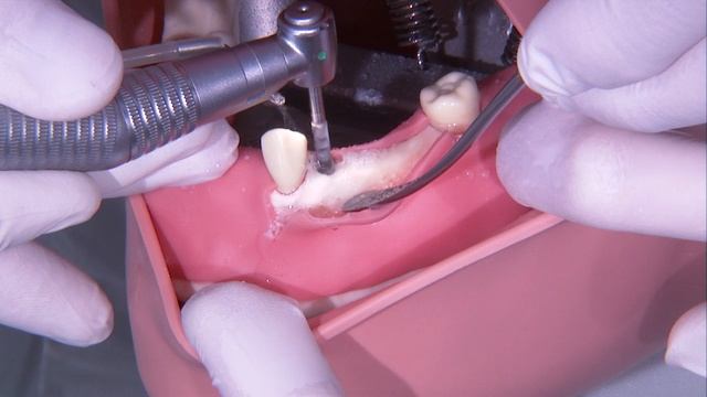 Упражнения на имплантах (6 часть, пилотная площадка 2)