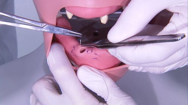 Немедленная имплантация (13 часть, закрытие раны)