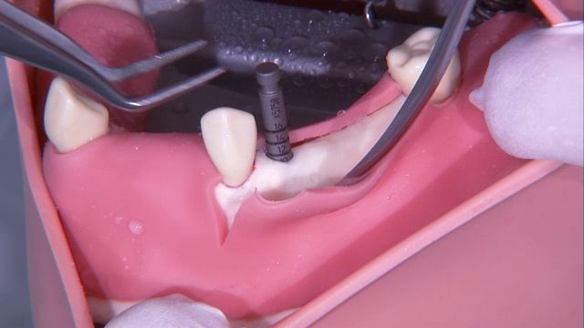 Упражнения на имплантах  (12 часть, измерение глубины)