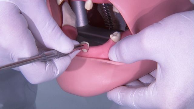 Упражнения на имплантатах (1 часть, разрез)