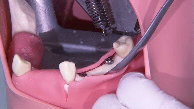 Упражнения на имплантах (21 часть, вставка закрывающего винта и защитного колпачка)