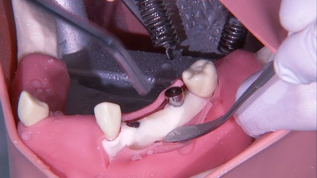 Упражнения на имплантах (22 часть, уборка операционного поля)