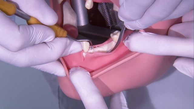 Упражнения на имплантатах (3 часть, очистка поверхности  кости)