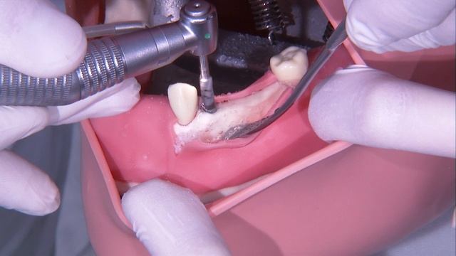 Упражнения на имплантах (9 часть, подготовка площадки спиральным сверлом)