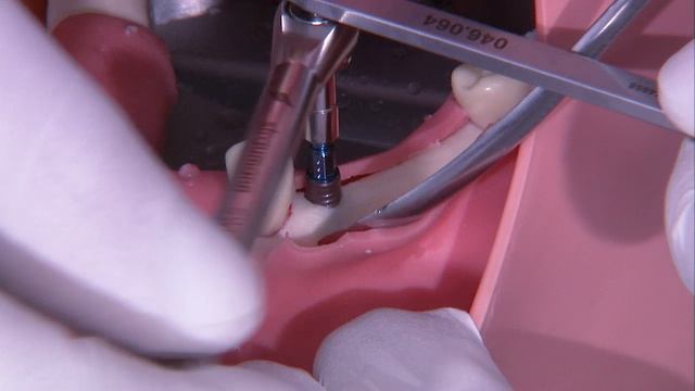 Упражнения на имплантах (16 часть, установка имплантата в область 34 (уровень кости))