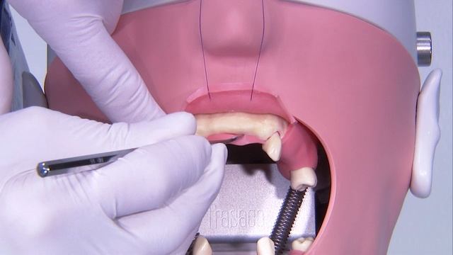 4Упражнения на имплантах (4 часть, точечное сверление (для обозначение места установки импланта)