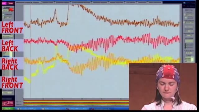 Живая демонстрация ЭЭГ во время ТМ