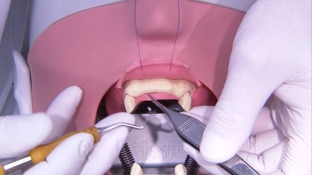 Имплантология (5 часть, очистка поверхности кости)