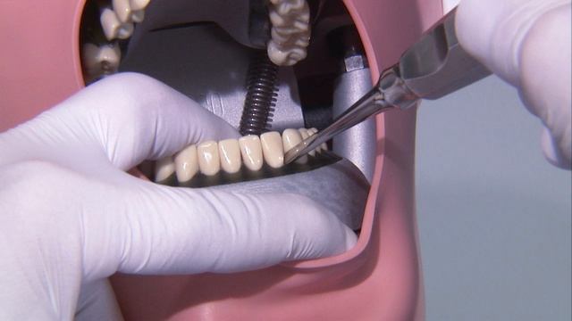 Удаление зуба (8 часть, подвывих с использованием подъемника)