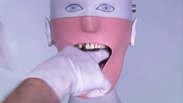 Альгинатный оттиск (4 часть, cнятие оттиска нижней челюсти)