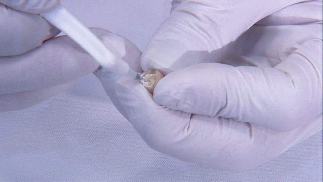 Изготовление временной коронки (11 часть, фиксация временным цементом)