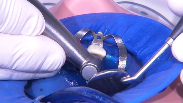 Эндодонтия (1 часть, вскрытие пульпарной камеры)