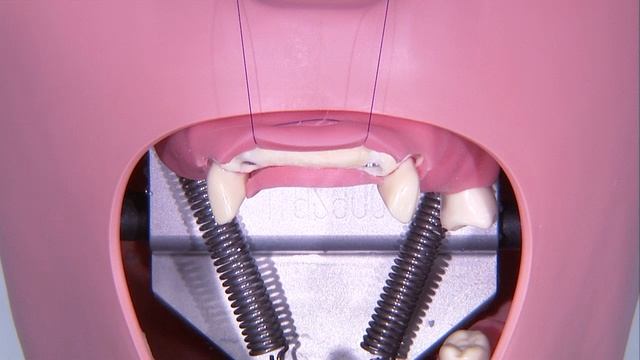 Имплантология (20 часть, закрутка фиксирующих винтов с помощью отвертки SCS )
