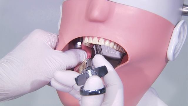 Местная анестезия (1 часть, проводниковая анестезия нижнеальвеолярного нерва нижней челюсти)