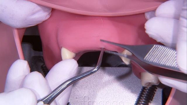 Имплантология (2 часть, подъем закрылок)