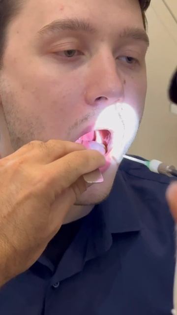 Криоорошение при тонзиллофарингите