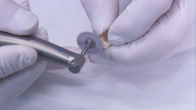 Изготовление временной коронки (9 часть, обрезка временных)