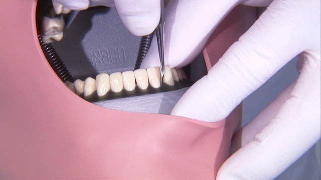 Удаление зуба (7 часть, синдесмотомия, зуб 32)