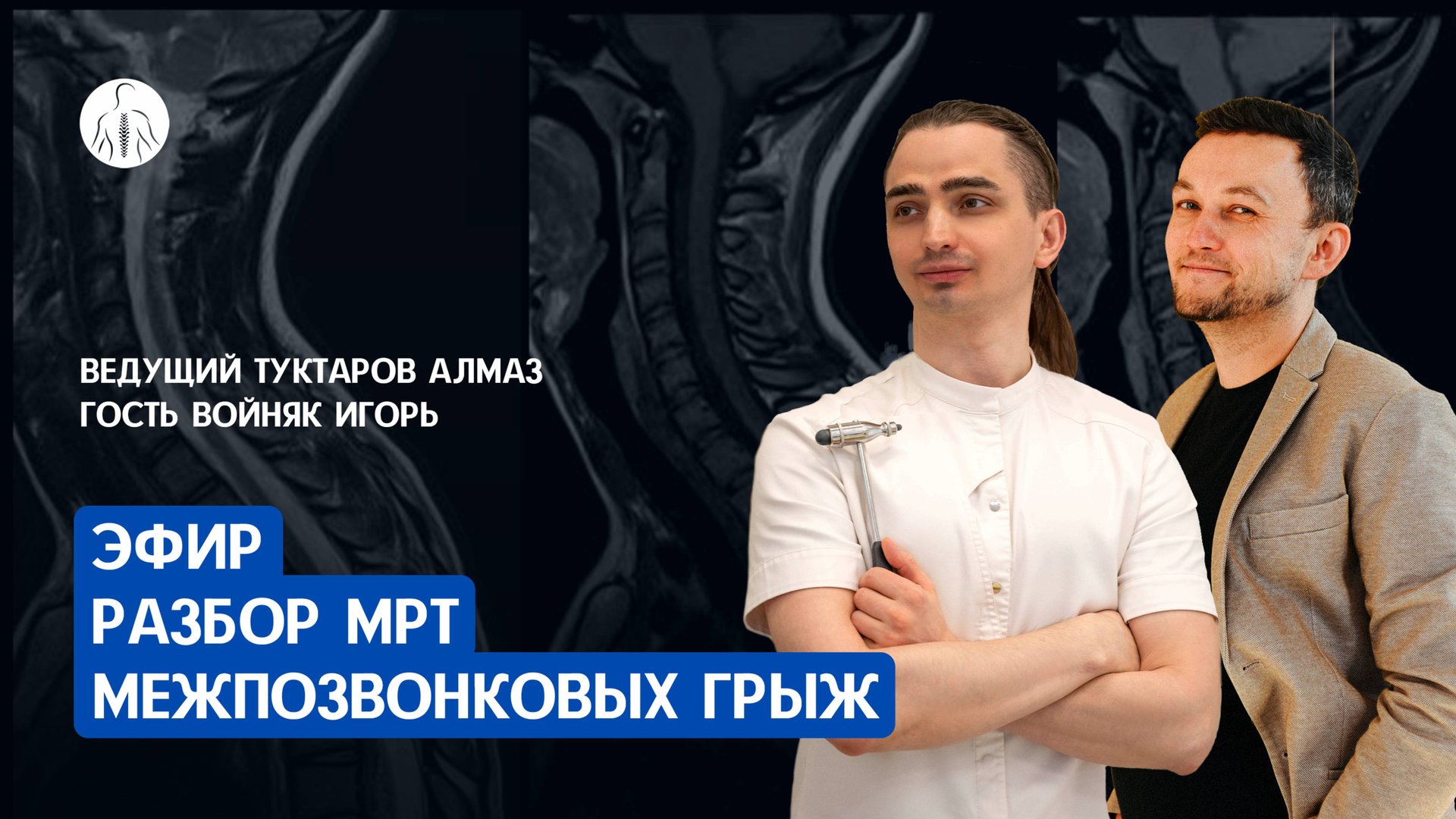 Эфир "Разбор МРТ межпозвонковых грыж от невролога"