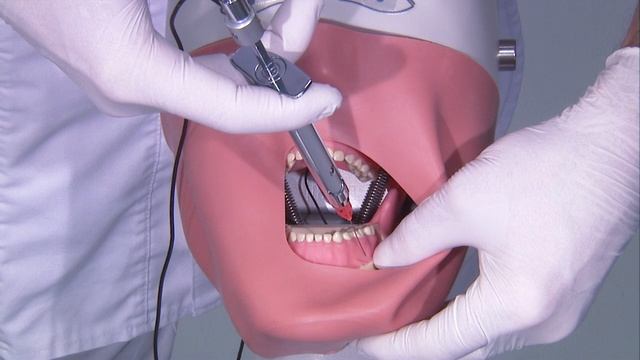 Местная анестезия (5 часть, проводниковая анестезия в детской челюсти на уровне зуба 75) Симуляция.