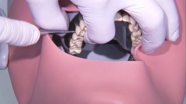 Удаление зуба (5 часть, подвывих с использованием подъемника)