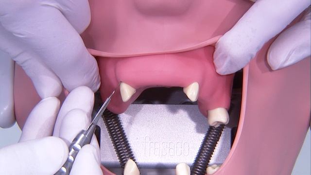 Имплантология (1 часть, разрез)