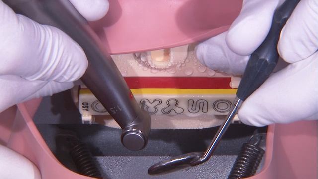 Упражнение на верхней челюсти с непрямым обзором