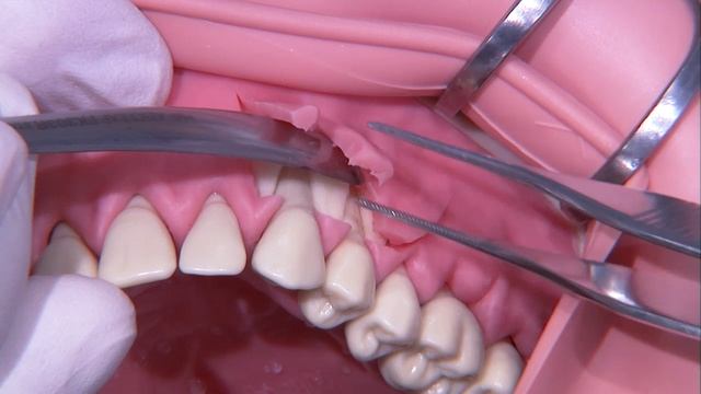 Пластическая хирургия пародонта (6 часть, подготовка принимающей площадки)