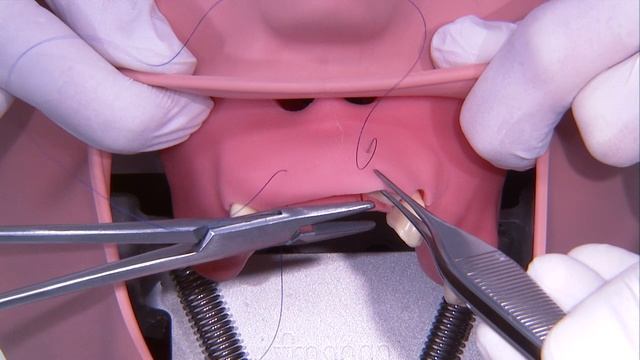 Имплантология (3 часть, подвесной шов)