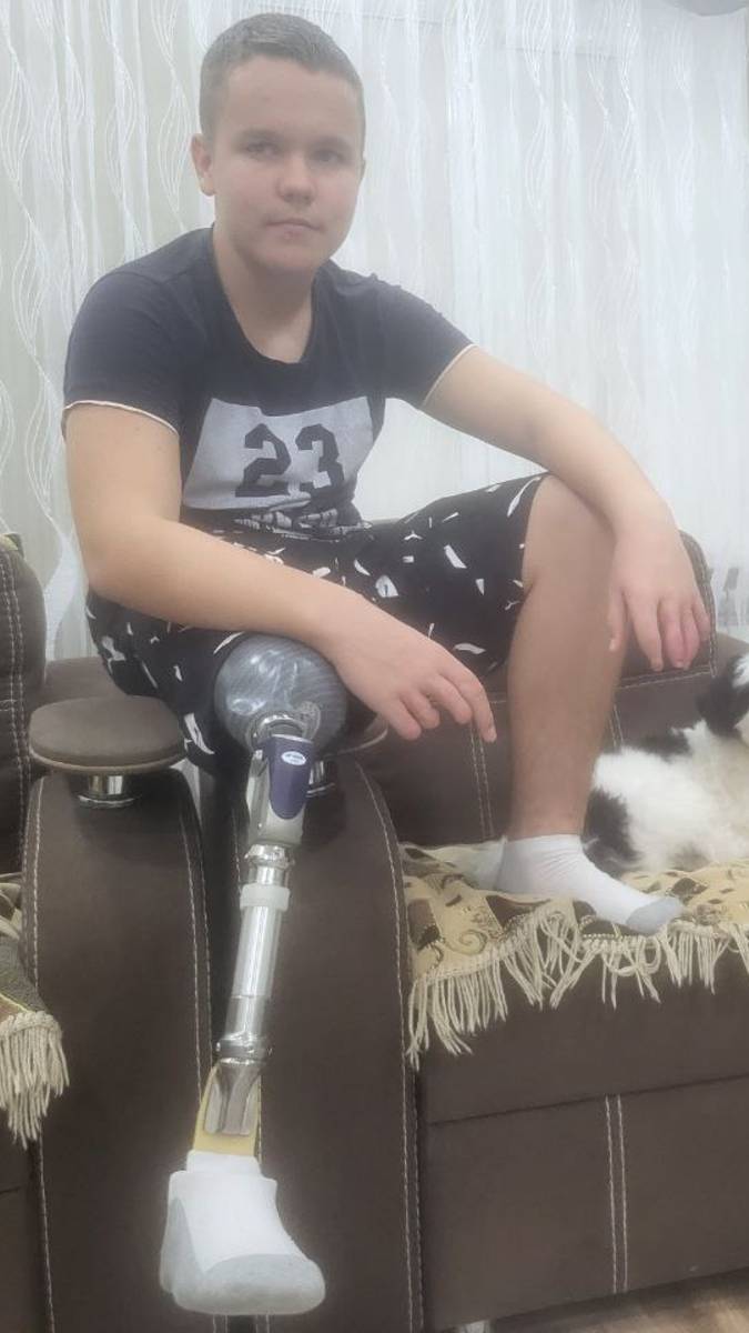 Матвей ходит на кибер ноге!
