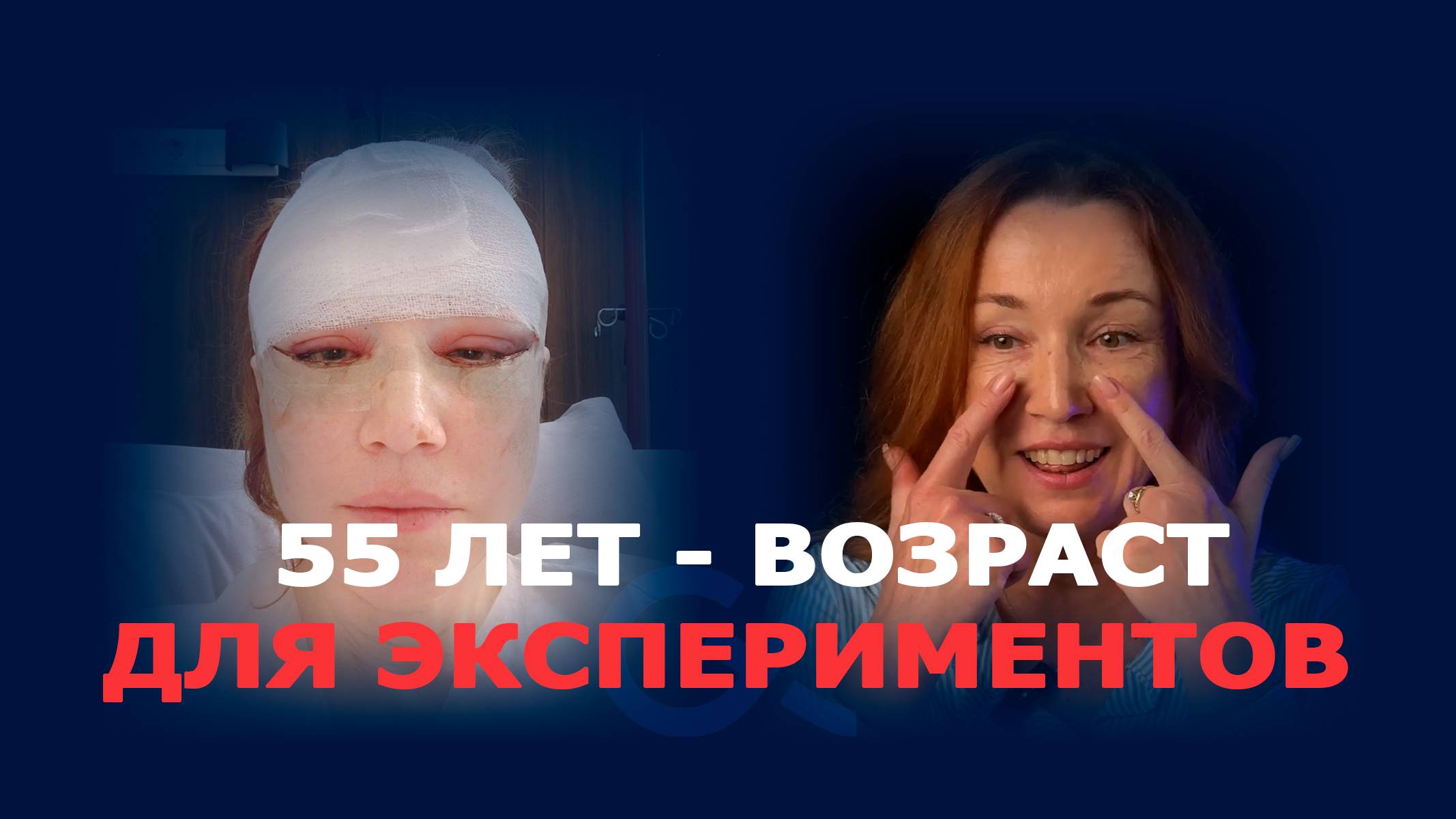 Омоложение без лишнего: чик-лифтинг и блефаропластика