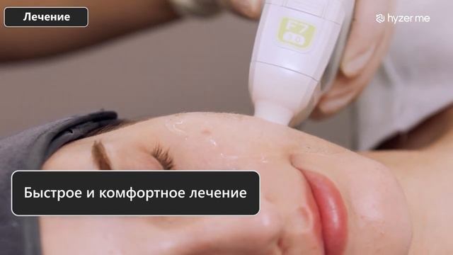 Hyzer me - аппарат для безоперационных процедур, способствующих подтяжке лица и лифтингу кожи.