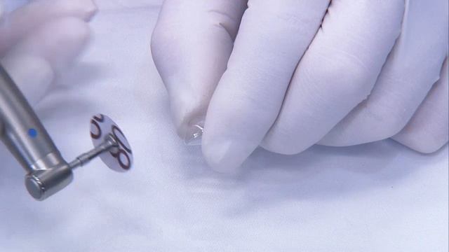 Изготовление временной коронки (3 часть, регулировка коронки полосы)