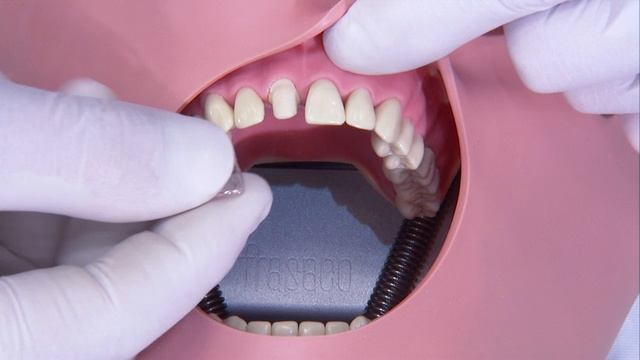 Изготовление временной коронки (1 часть, визуальная оценка)