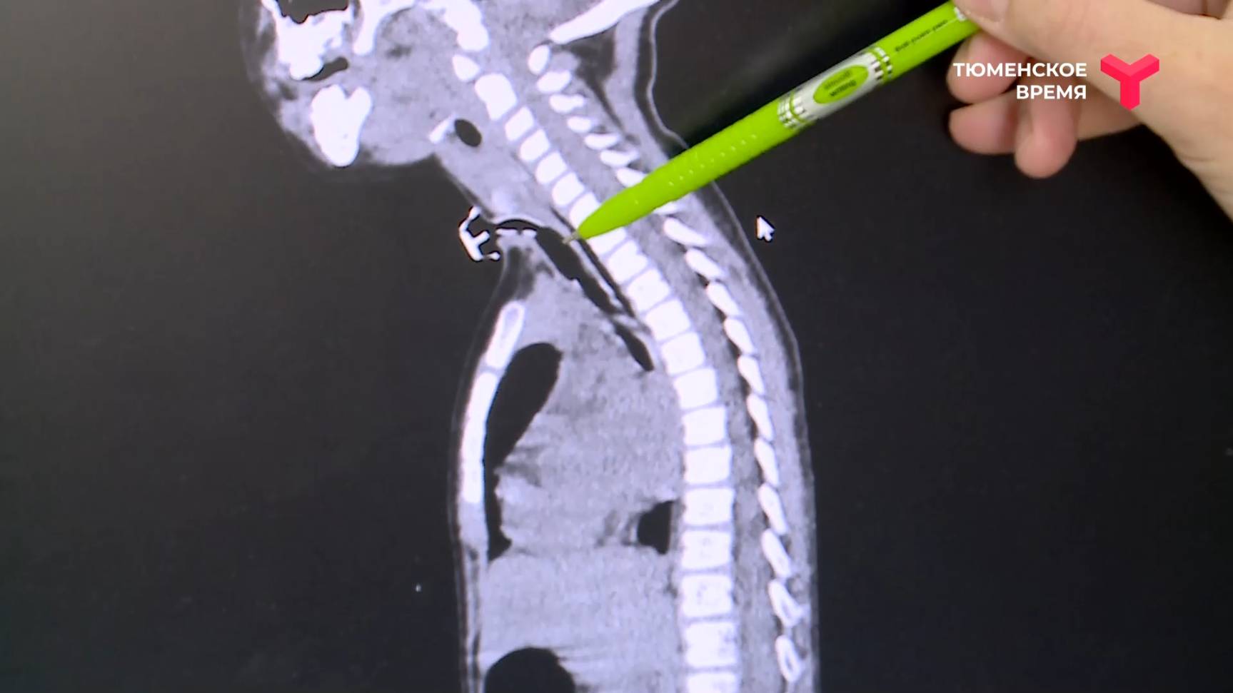 День здоровья | 17.10.2025