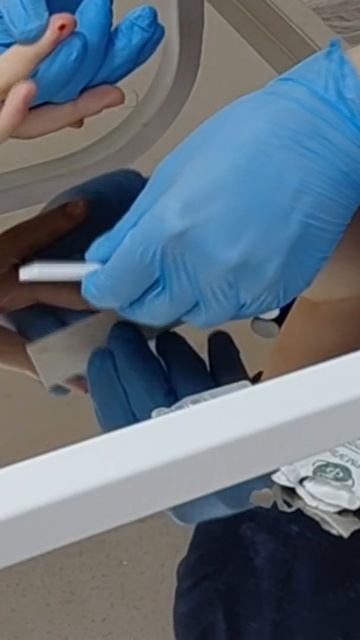 Проведение экспресс теста на ВИЧ