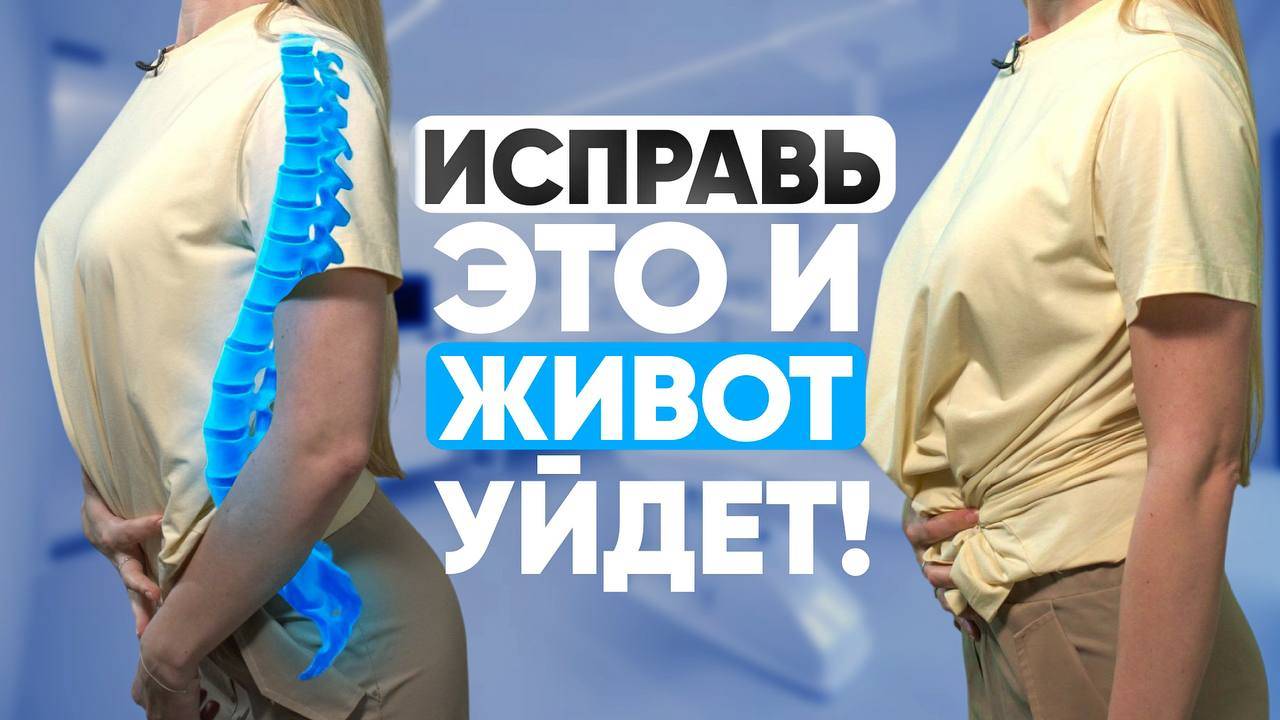 Как убрать ГИПЕРЛОРДОЗ? Это поможет вам избавиться от выпирающего живота!