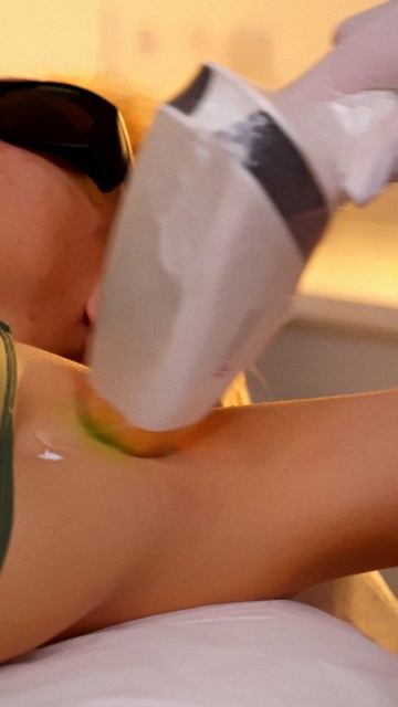 Лазер для лазерной эпиляции