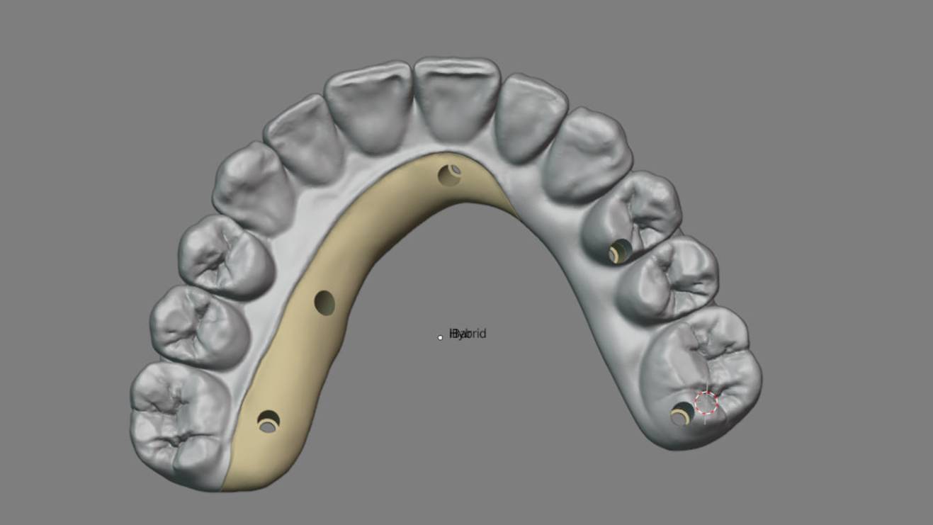Балочная конструкция с частичной дифференциацией опорных элементов