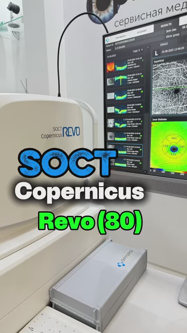 Оптический когерентный томограф — SOCT Copernicus REVO 80 для точной и предсказуемой диагностики