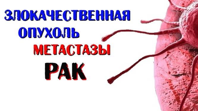 Что такое рак, злокачественная опухоль?