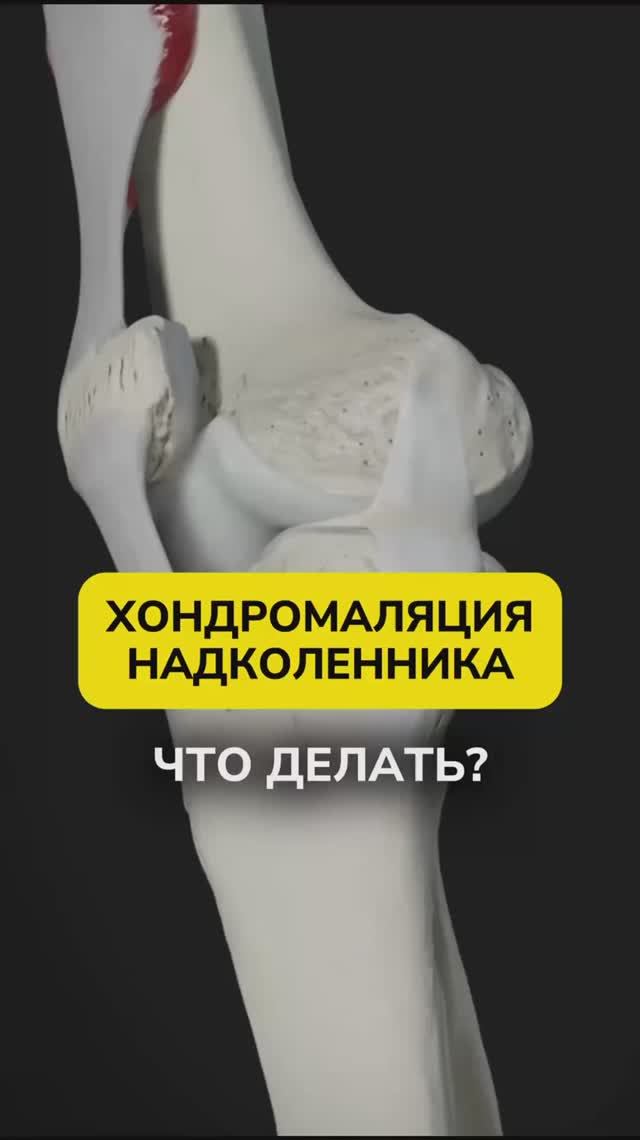 ЧТО ТАКОЕ МОБИЛЬНОСТЬ?