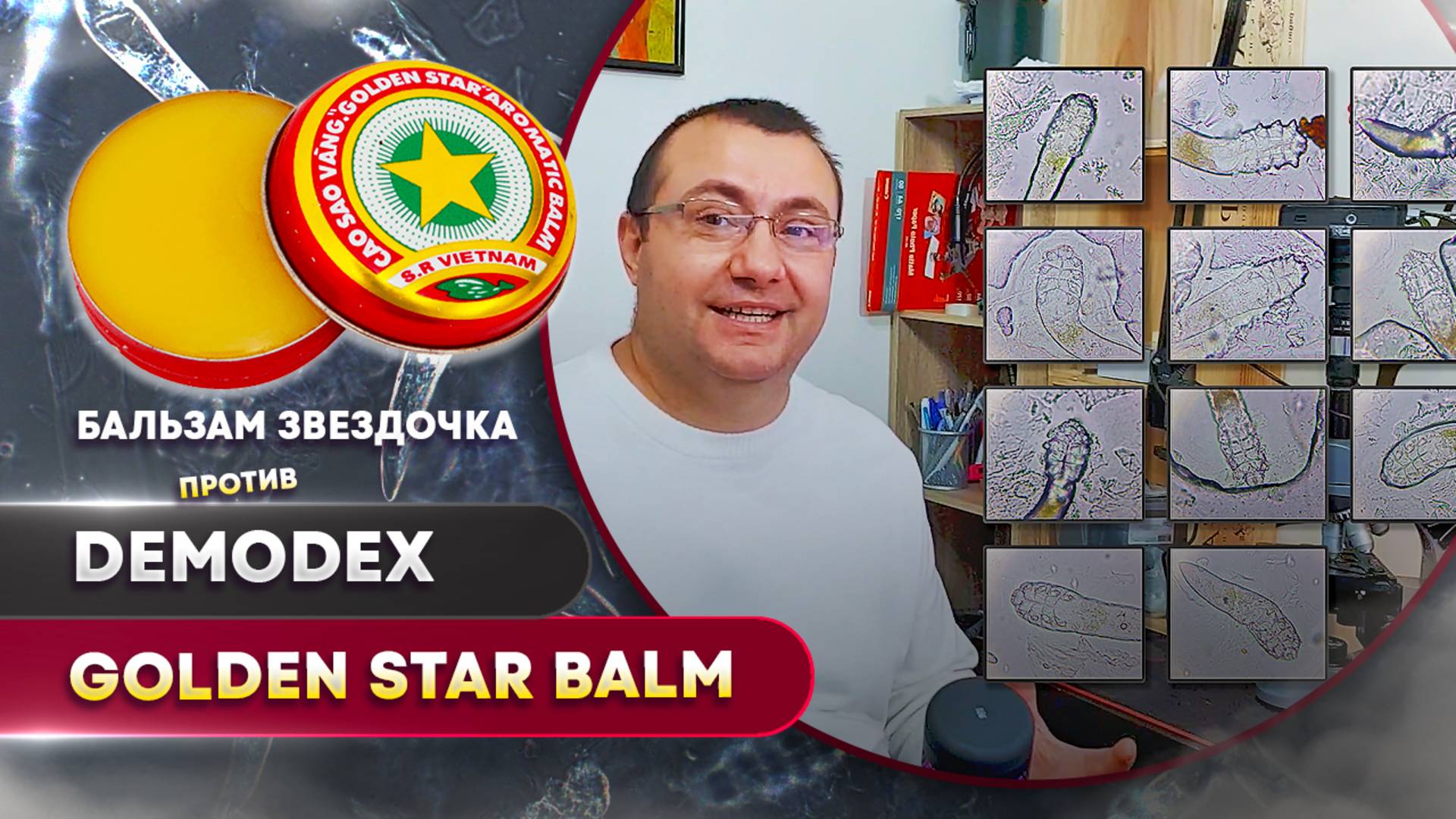 Демодекс под микроскопом — Звёздочка против клеща! Как убить демодекса? Реальный эксперимент!