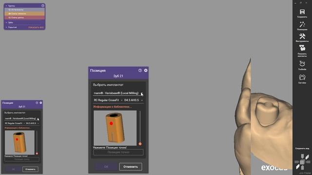 Совместимость имплантационных систем Штрауманн и Медентика в программе EXOCAD