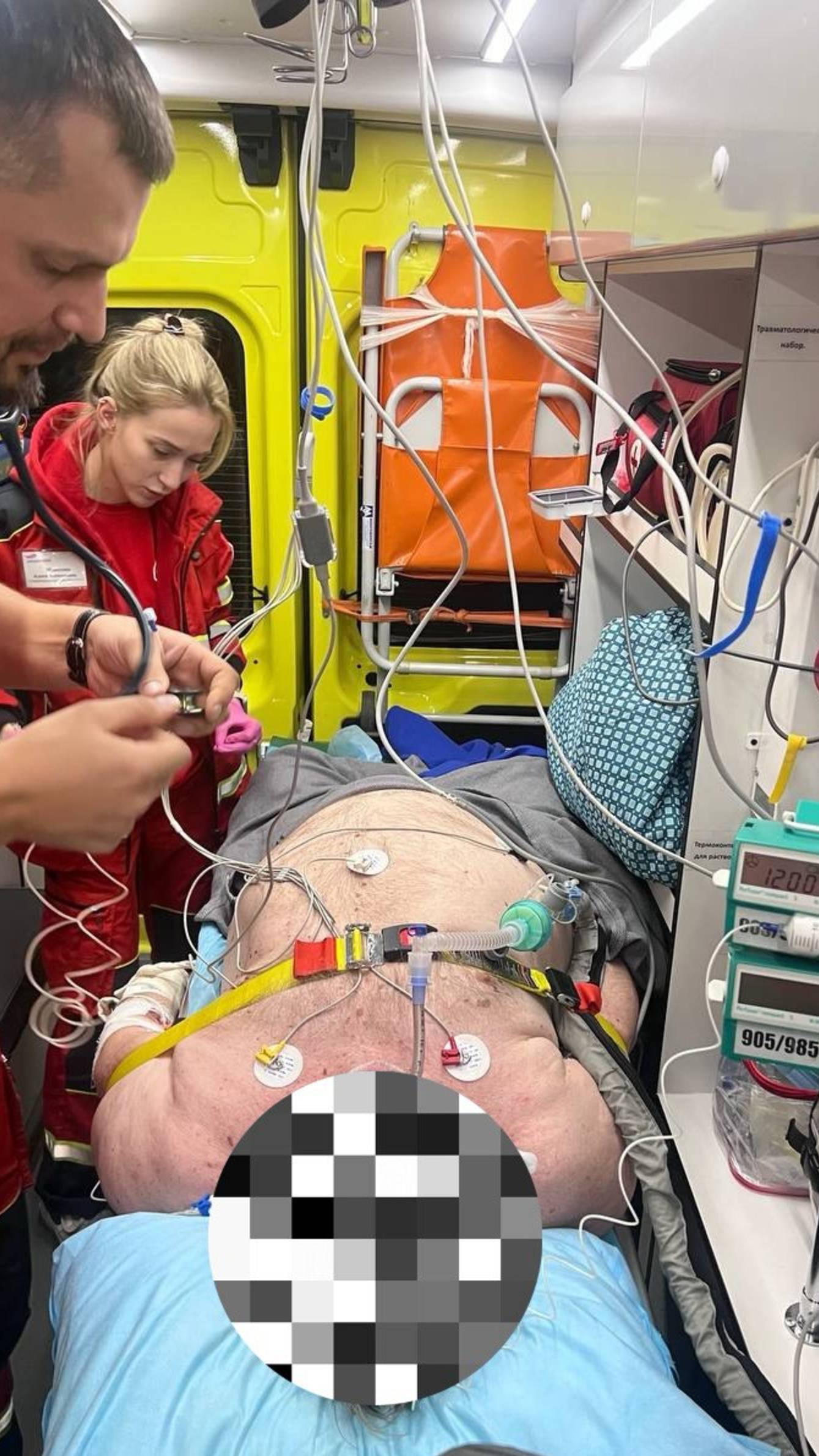 ИВЛ: спасение, а не приговор. Вся правда об искусственной вентиляции лёгких