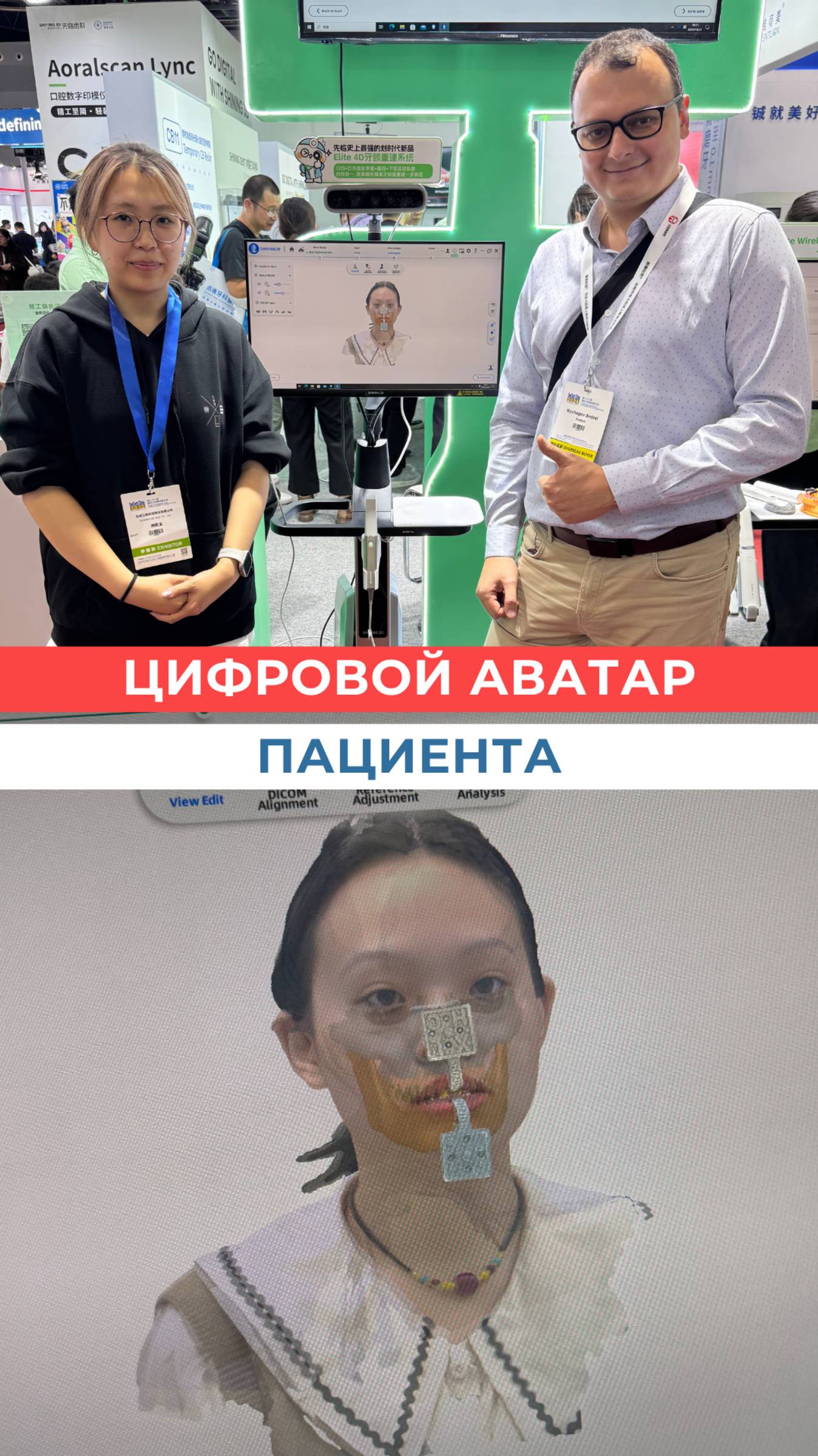 Компания Shining 3D представила инновацию — систему для создания цифрового аватара пациента.