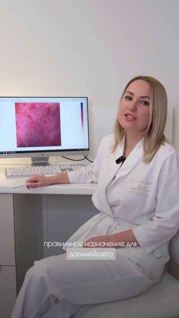 Удаление сосудистых звездочек на лице в Челябинске: фототерапия М22