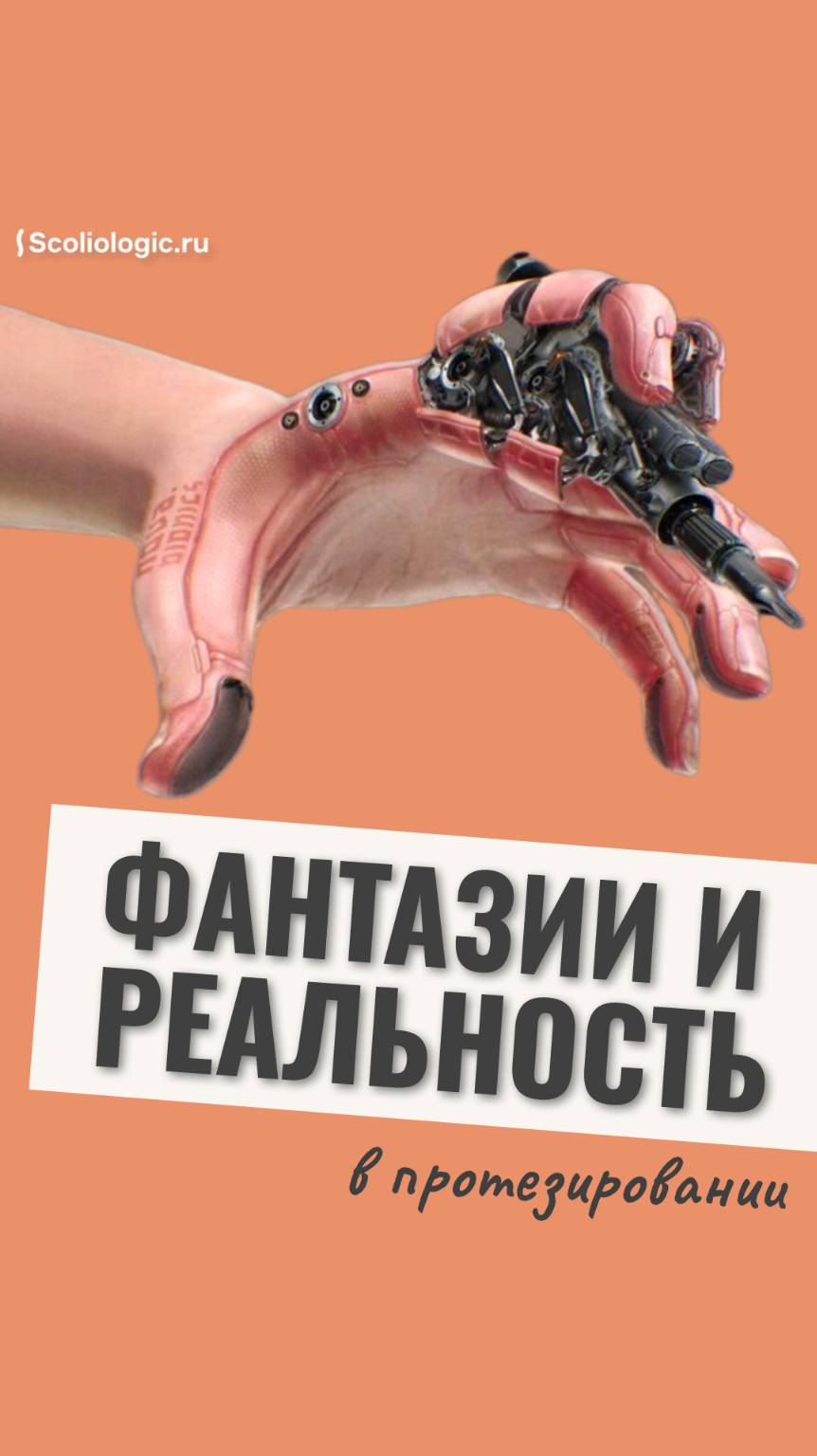 Реальные протезы и фантазии из интернета